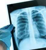 9 Essentials to Consider When Choosing a Radiology Imaging Center for ...